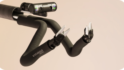 Vicarious Surgical Robot – R.D.D. Smith